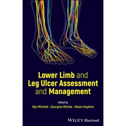Lower Limb and Leg Ulcer Assessment and Management | BestPrice.gr